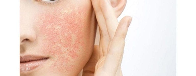 Is your skin sensitive or sensitized? - The Banwell Clinic